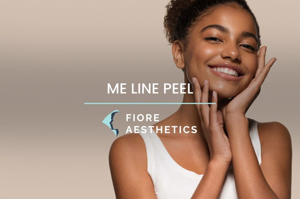 Me Line Peel - Pigmentation Peel | Fiore Aesthetics
