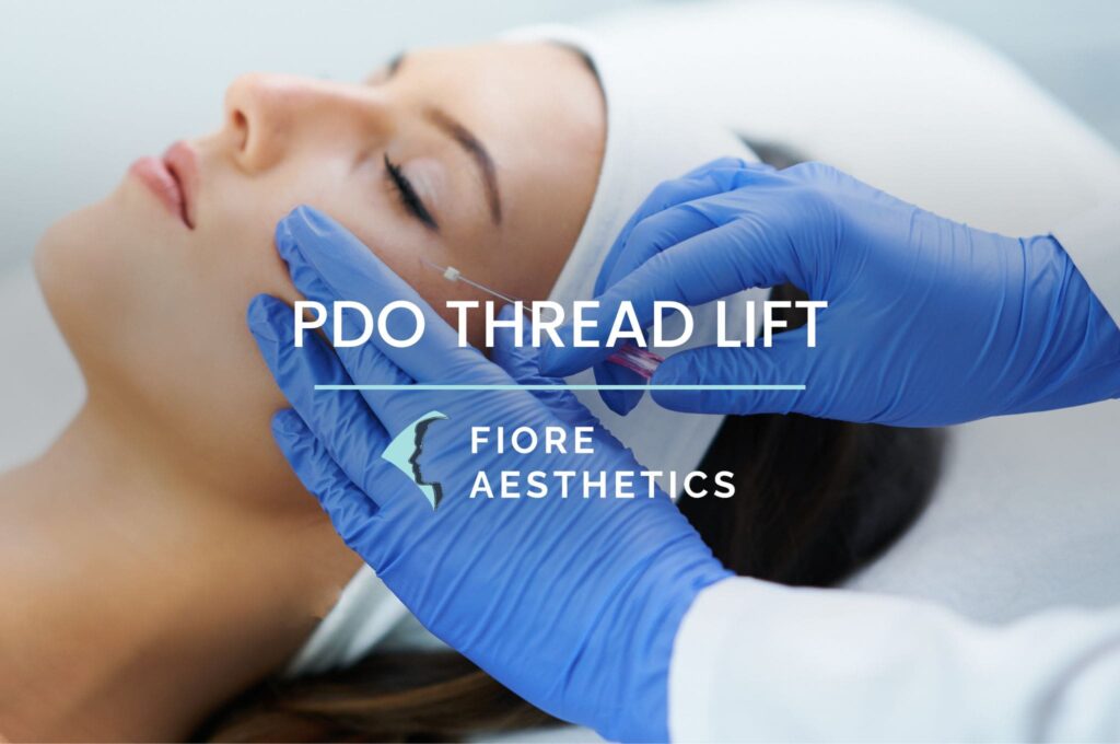 PDO Thread Lift London | Lifting Threads